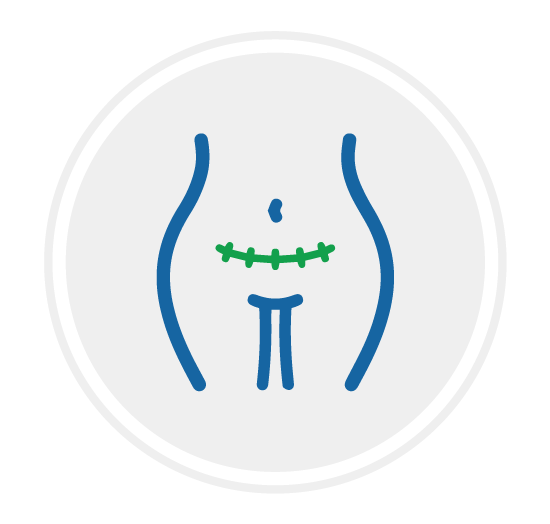 Scar Tissue Support — Biomedic Labs
